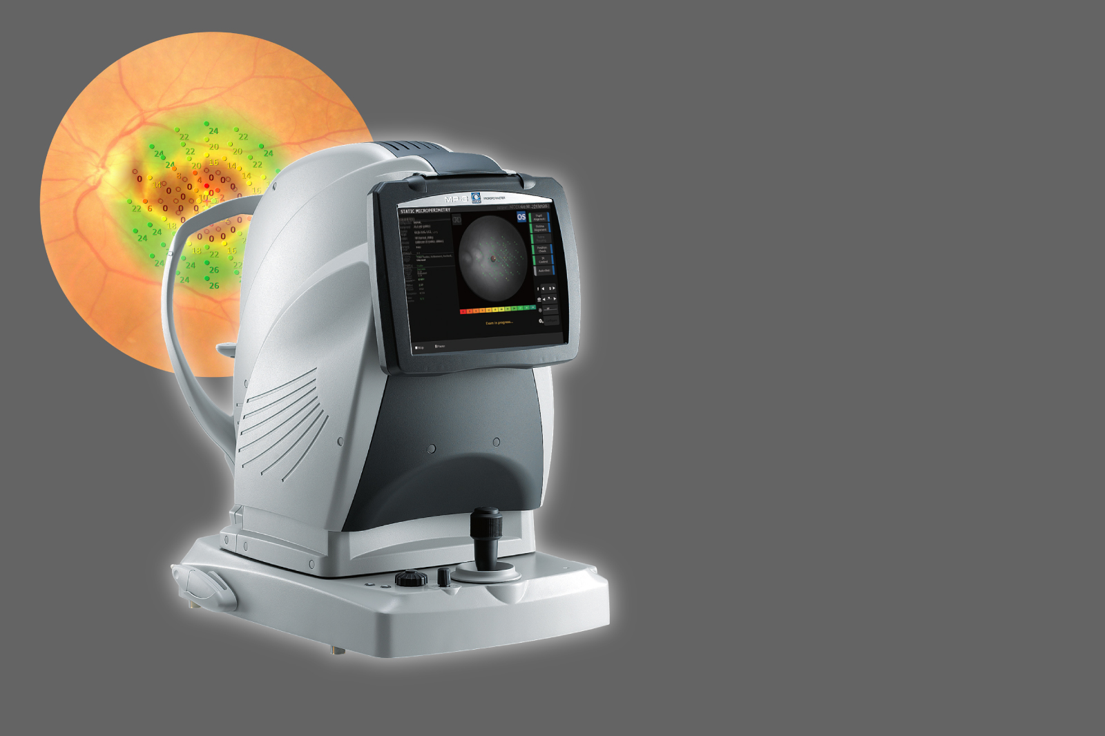 NIDEK | MP-3 Microperimeter